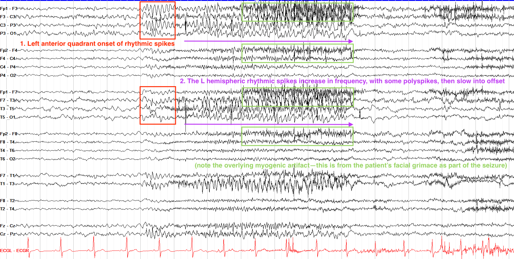 Blog Post #2 – Programming with Mario